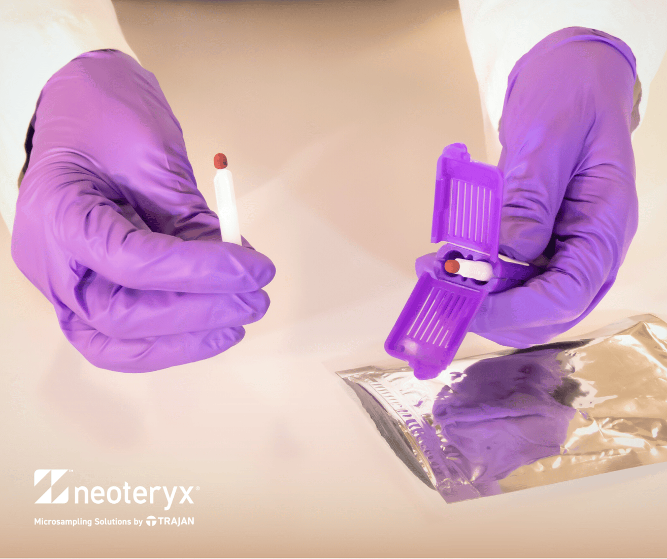 Microsamples from Cyclists Provide Clues to Treat and Prevent Diseases