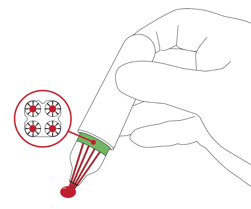 Variances in DBS Observed for Neonatal Screening