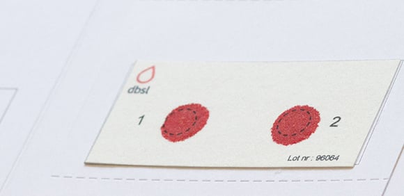 why use dried blood tests vs. wet blood tests?