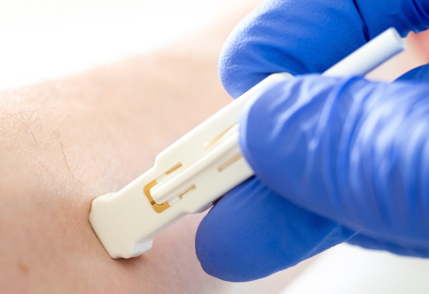 Microsampling Blog | Neoteryx | Skin Microsampling, Microbiopsy