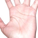 Capillary Puncture Sites: 5 Common Methods for Microsampling