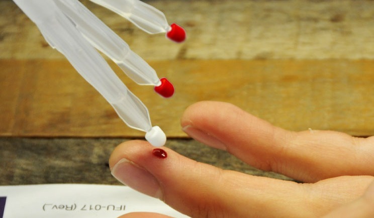 Microsampling Helps Stanford Researchers Develop 'Theranos That Works'