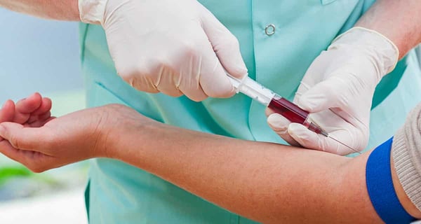 How To Draw Blood at Home the Easy Way Using a Sample Collection Kit