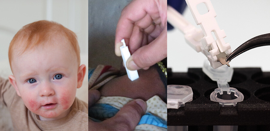 Harpera Micro-Skin Biopsy Punch | Minimally Invasive Sampling