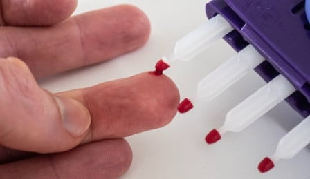 scientific Specimen Collection, Simplified | Microsampling Devices