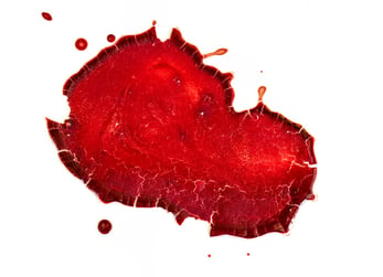 Why Dried Blood Tests Are Superior to Wet Blood Tests