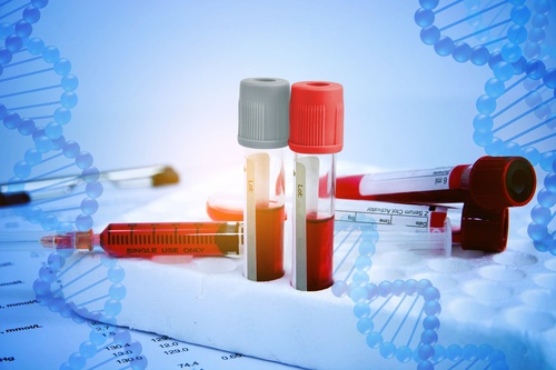 A Brief History of Blood Collection Systems and Devices