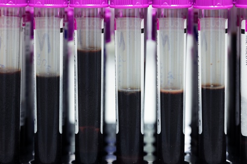 using dry ice for the transport of blood samples: is it possible?