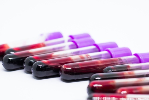 blood plasma alternative: plasma versus blood and capillary integrity