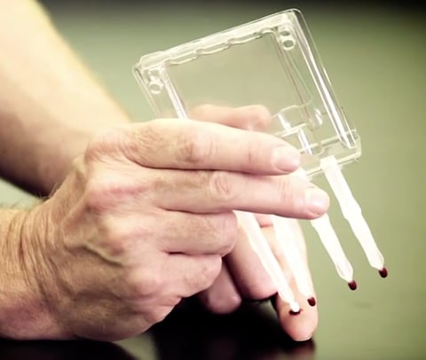 Microsampling: Antarctica Explorers Track Impact of Climate on Humans