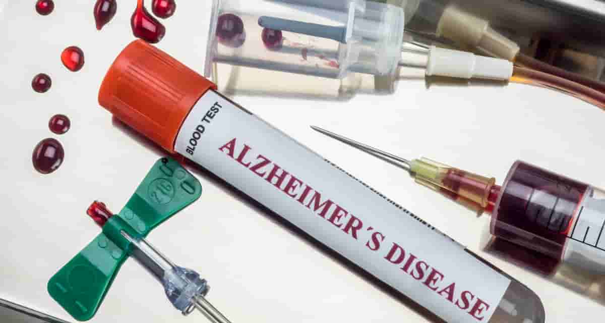 can a blood test for Alzheimer's disease provide clues for a cure?